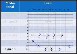 LAUDO AUDIOLÓGICO NA AUDIOMETRIA TONAL I GRATUITO - online - Sympla