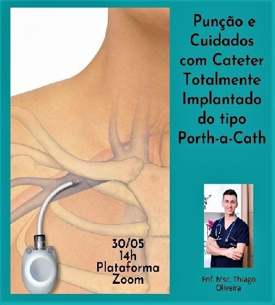Mini Curso: Punção e Cuidados com Cateter totalmente implantado do tipo ...