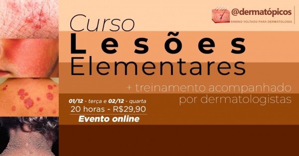 Curso Lesões Elementares Dermatópicos - 2ª edição - online - Sympla