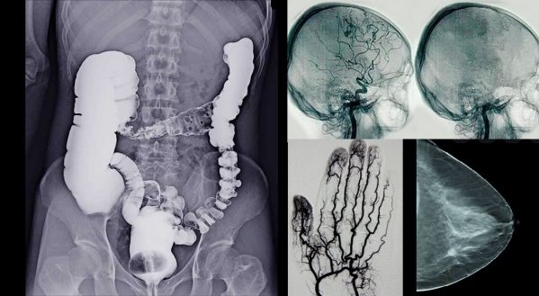 MEIOS DE CONTRASTE RADIOLÓGICOS - online - Sympla