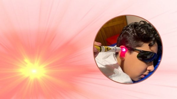 CURSO DE ACUPUNTURA A LASER PARA CRIANÇAS - online - Sympla