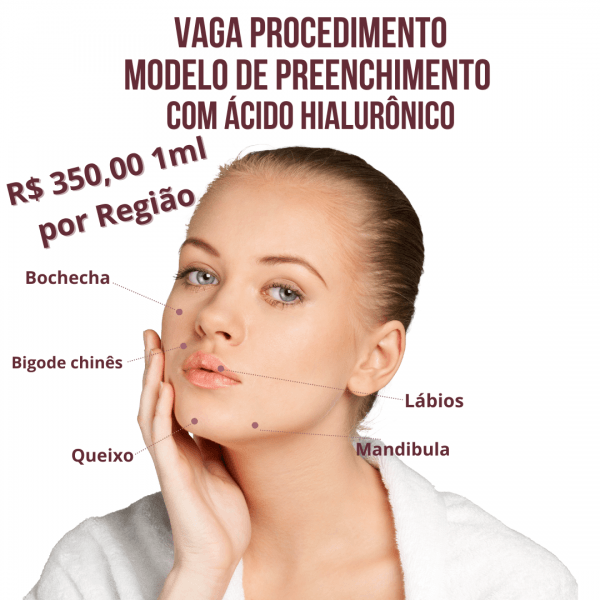 Vaga Procedimento Modelo Preenchimento Facial com Ácido Hialurônico em ...