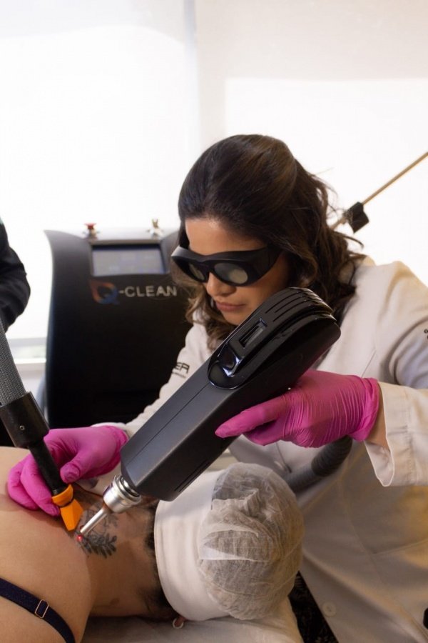 CURSO DESPIGMENTAÇÃO A LASER ND-YAG QSWITCHED COM LASER Q CLEAN (Cópia ...