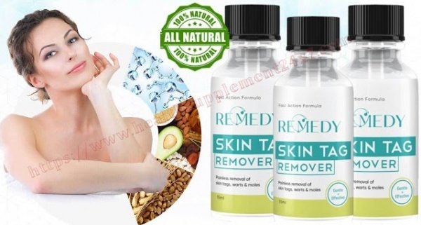 Remedy Skin Tag Remover Reviews [Updated 2023] Does It Really Work? You ...